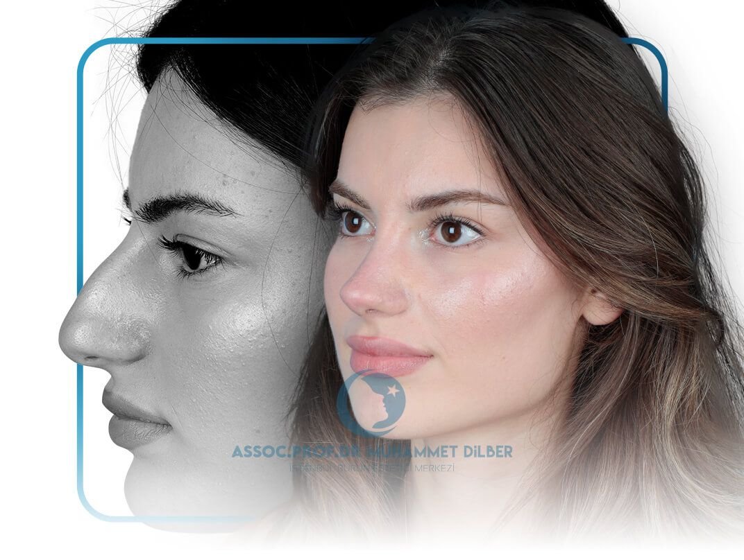 Assoc. Prof. Dr. Muhammet Dilber - Istanbul Rhinoplasty Center